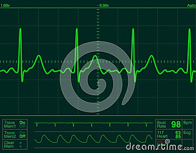 Heart Monitor Screen Royalty Free Stock Images - Image: 4819539