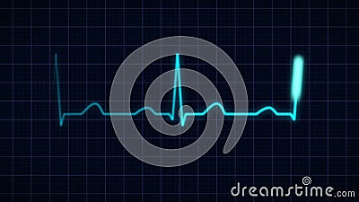 Heartbeat curve stock video. Video of electrocardiogram - 80684365