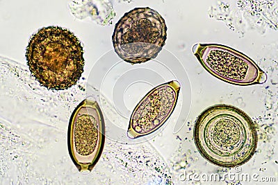 Helminth Eggs Stock Photo - Image: 70356359