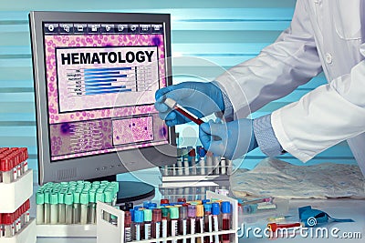 Hematology Test. Technician In Hematology Lab Testing Blood Samp Stock ...
