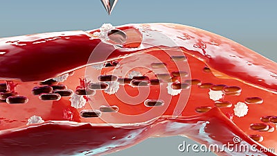 Hemostasis. Basic Steps of Wound Healing Process. Animation. Cross ...