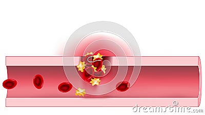 Hemostasis. Basic Steps of Wound Healing Process. Stock Video - Video ...