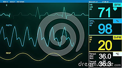 Electrocardiogram, ECG, Hartmonitor Stock Footage - Video of hartslag ...