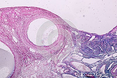 Histological Sample Ovary Of Rabbit Tissue Under The Microscope. Stock ...