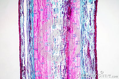 Histological Structure Of Pine Stem Vascular Bundle Under Microscope ...