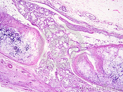 Histology Of Epiglottis Human Tissue Royalty-Free Stock Photography ...