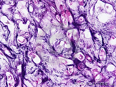 Histology Of Epiglottis Human Tissue Royalty-Free Stock Image ...