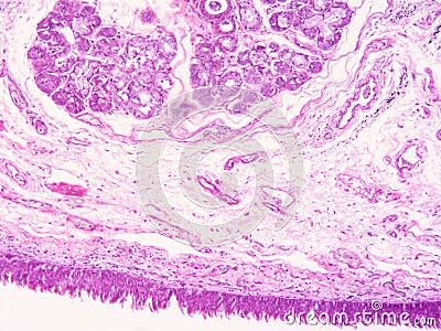 Histology Of Epiglottis Human Tissue Royalty-Free Stock Photo ...