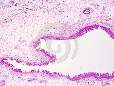 Histology Of Epiglottis Human Tissue Stock Photography | CartoonDealer ...