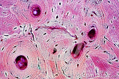 Histology Of Human Compact Bone Tissue Under Microscope View For ...