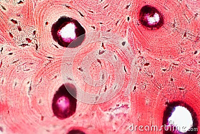 Histology Of Human Compact Bone Tissue Under Microscope View For ...