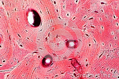 Histology Of Human Compact Bone Tissue Under Microscope View For ...