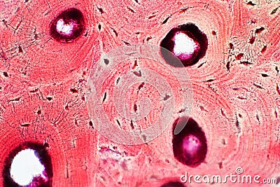 Histology Of Human Compact Bone Tissue Under Microscope View For Stock ...