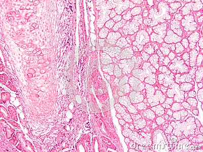 Histology Of Human Larynx Tissue Royalty-Free Stock Photography ...