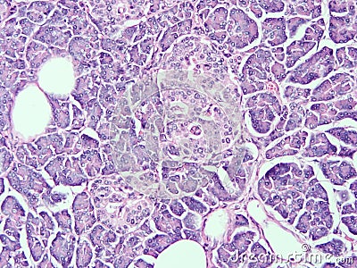 Histology Of Human Pancreas Tissue Stock Photography | CartoonDealer ...