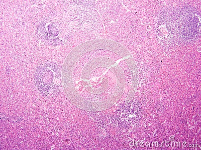 Histology Of Human Pancreas Tissue Stock Image | CartoonDealer.com ...