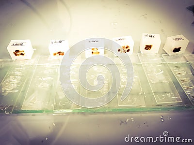 Histology Paraffin Embedded Tissue Samples Into A Slide Stock ...