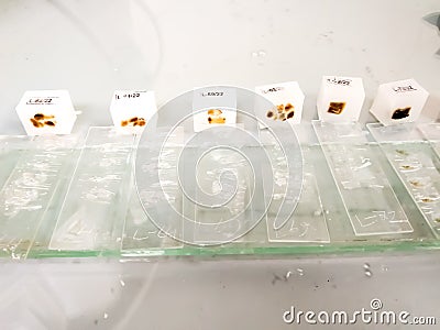 Histology Paraffin Embedded Tissue Samples Into A Slide Stock Photo ...