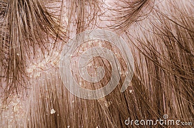 Hoofdroos Royalty-vrije Stock Foto's - Afbeelding: 30788278