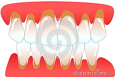Human Anterior Teeth Royalty-Free Stock Image | CartoonDealer.com ...