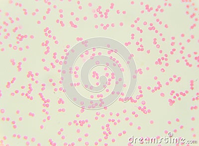 Human Blood Under The Microscope (Blood Smear Human) Royalty-Free Stock ...