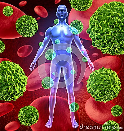 Human Body With Cancer Cells Spreading And Growing Stock Photo ...