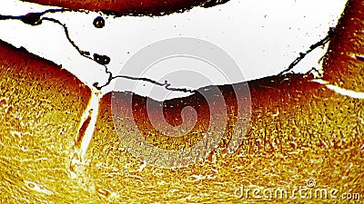 Human Cerebellum Filmed Under Microscope with 200x Magnification on ...