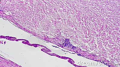Human Cerebrum in Section with High Magnification 100x Shown Under ...