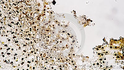 Human Cholangiole in Section Under Microscope with 400x Magnification ...