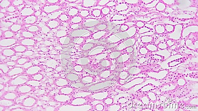 Human Kidney Tissue is Magnified in 200x Under Microscope and Filmed on ...