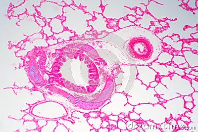 Human Lung Tissue Under Microscope View Stock Photography ...