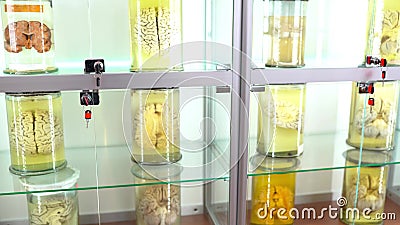Human Organs in Jars with Formalin in Anatomical Museum Stock Video ...