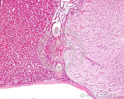 Human Pituitary Gland. Intermediate Lobe Stock Photo | CartoonDealer ...