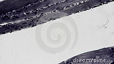 Human Skeletal Muscle Under Microscope 400x in Longitudinal Section ...