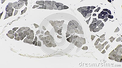 Human Skeletal Muscle Under Microscope with 200 Times Magnification on ...