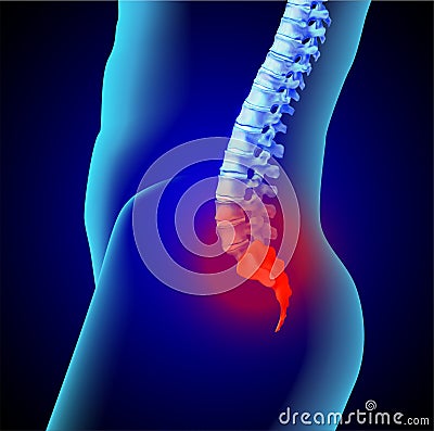 Human Spine And Tailbone. Inflammatory Process. Cartoon Vector ...