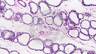 Human Thyroid Gland in Section Magnified 200x Under Light Micrograph on ...