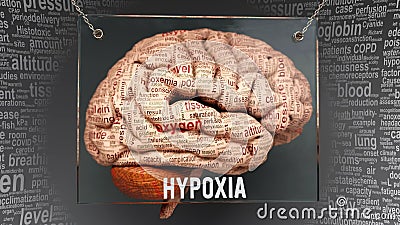 Hypoxia In Human Brain Stock Photography | CartoonDealer.com #247090820