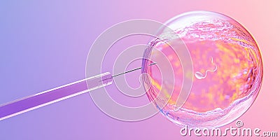 Illustration Of Egg Cell Being Injected With Sperm Using Needle ...