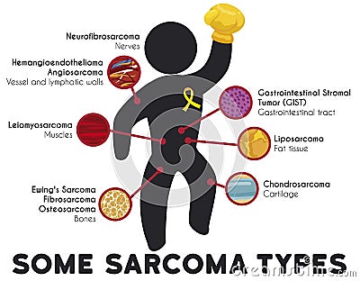Infographic Showing Some Sarcoma Types And Principal Affected Tissues ...