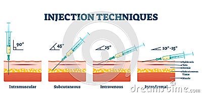 Injection Techniques Vector Illustration. Medical Procedure Examples ...
