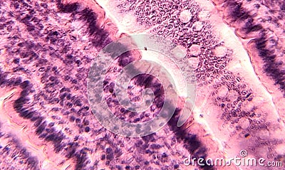 Intestinal Villi Under A Microscope Stock Image | CartoonDealer.com ...