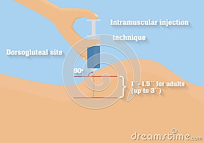 Intramuscular Injection Technique Vector Illustration. Technique Of ...