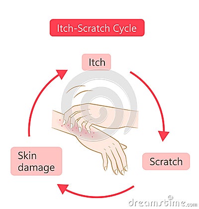 Itch Scratch Cycle Hands Illustration. Dry, Dermatitis And Atopic ...
