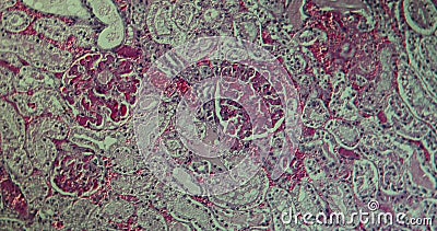 Kidney with Glomeruli and Baumanscher Capsule Stock Footage - Video of ...