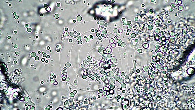 Movement of Milk Bacteria in Milk Leaven Under a Microscope Stock ...