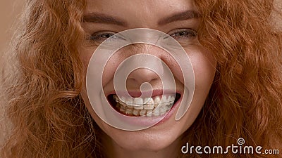 Lady with Braces Smiling Snapping Teeth Posing Over Beige Background ...