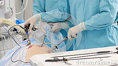 Laparoscopic Cholecystectomy Instrument. Real Surgery, Abdominal ...