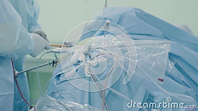 Laparoscopic Surgery of the Abdomen Stock Video - Video of human, room ...