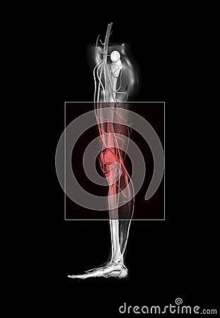 Leg Pain Royalty Free Stock Photography - Image: 3212767